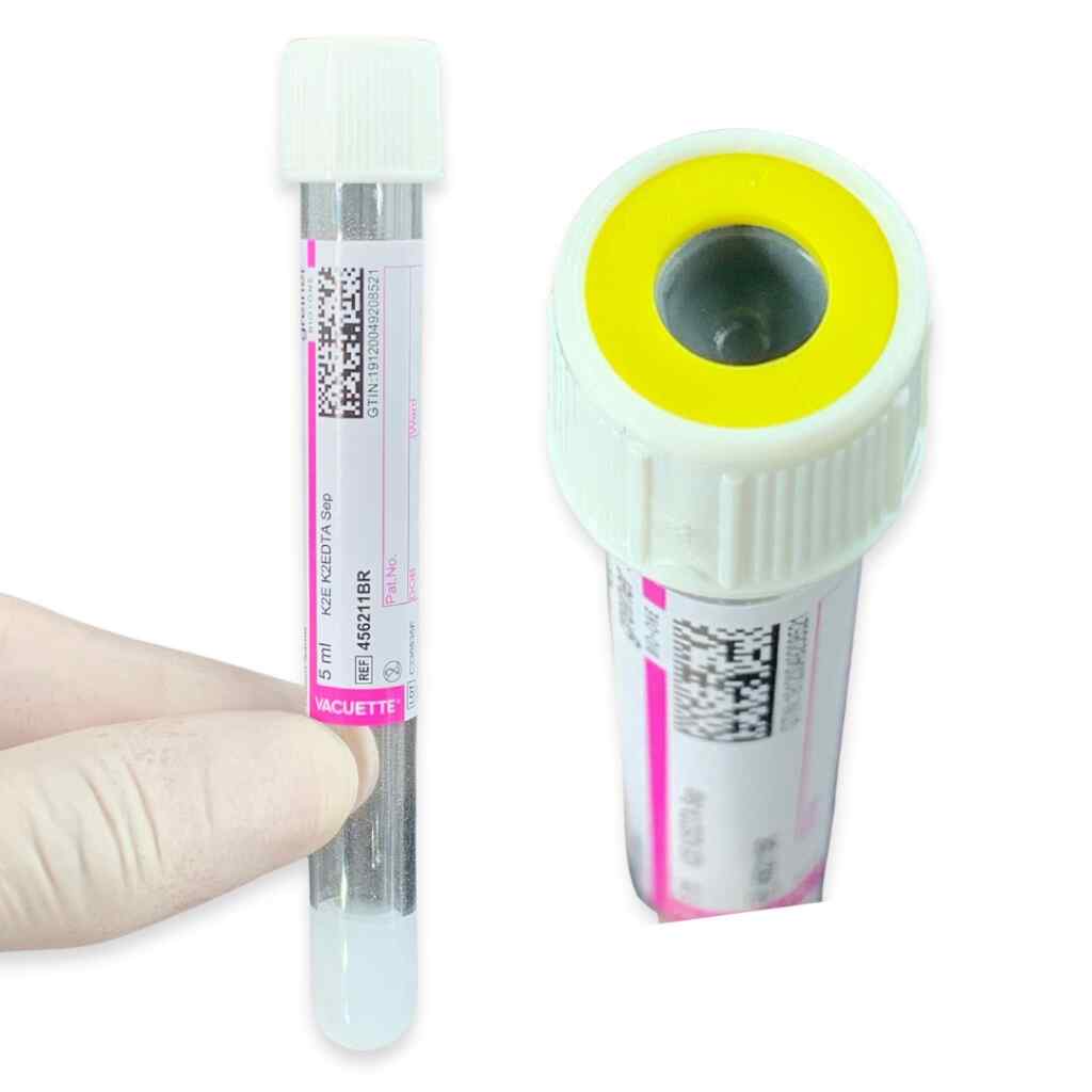 Tubo 5ml Com Edta K2 + Gel Ativador Tubo Tampa Branca Amarelo Greiner C ...